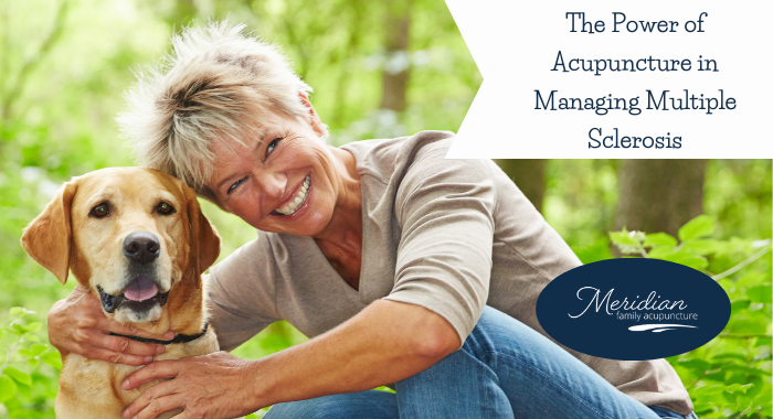 The Power of Acupuncture in Managing Multiple Sclerosis